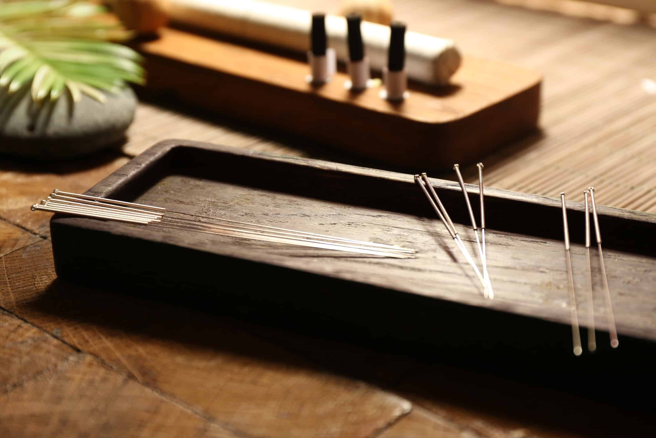 Acupuncture | Roman's Wellness Center | Morgantown, WV