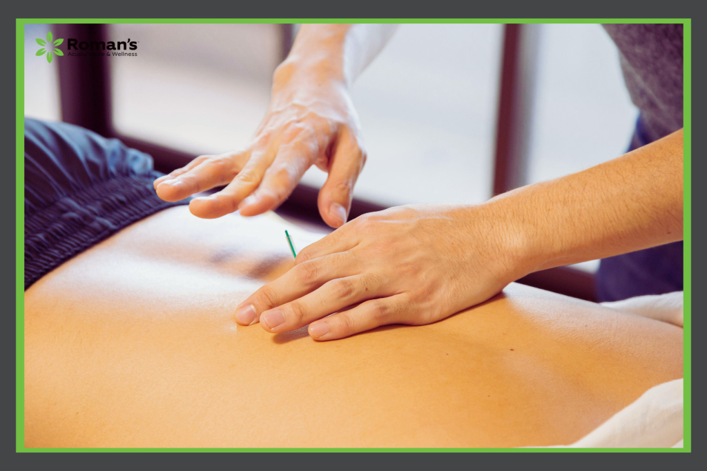 Acupuncture for Digestion | Roman's Wellness Center